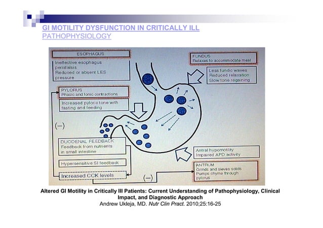 Gastrointestinal motility disorders in critically ill patients | PDF