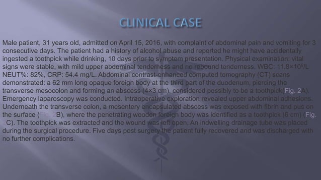 Gastro intestinal perforation | PPTX | Digestive Disorders | Diseases ...