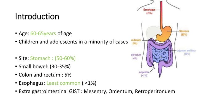Gastrointestinal Stromal Tumours (GIST).pptx