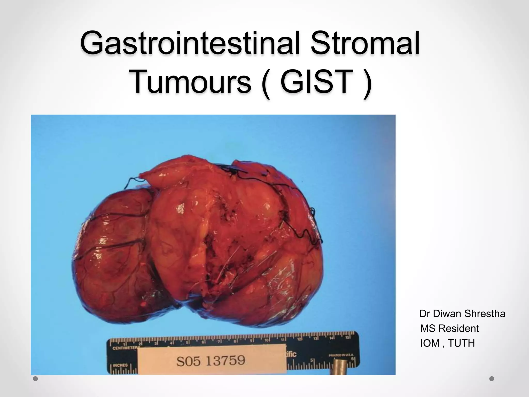Gastrointestinal Stromal Tumour Gist D1 Pptx Digestive Disorders Diseases And Conditions