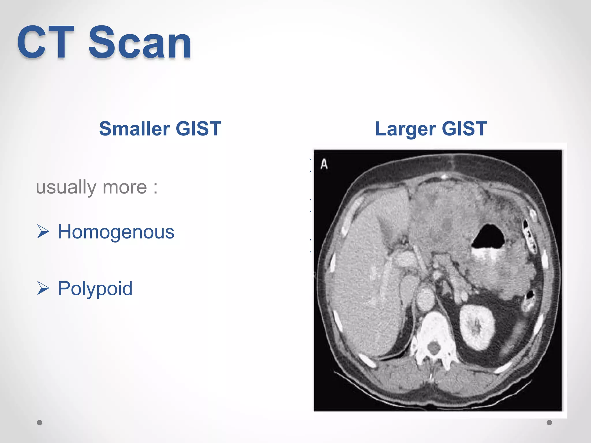 Gastrointestinal Stromal Tumour ( GIST) (D1) | PPTX