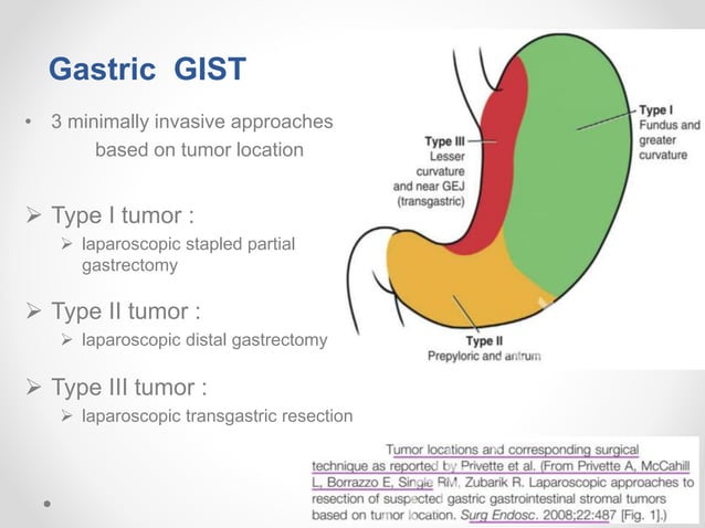 Gastrointestinal Stromal Tumour ( GIST) (D1) | PPT