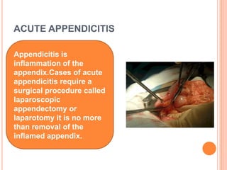 Gastrointestinal surgery | PPTX