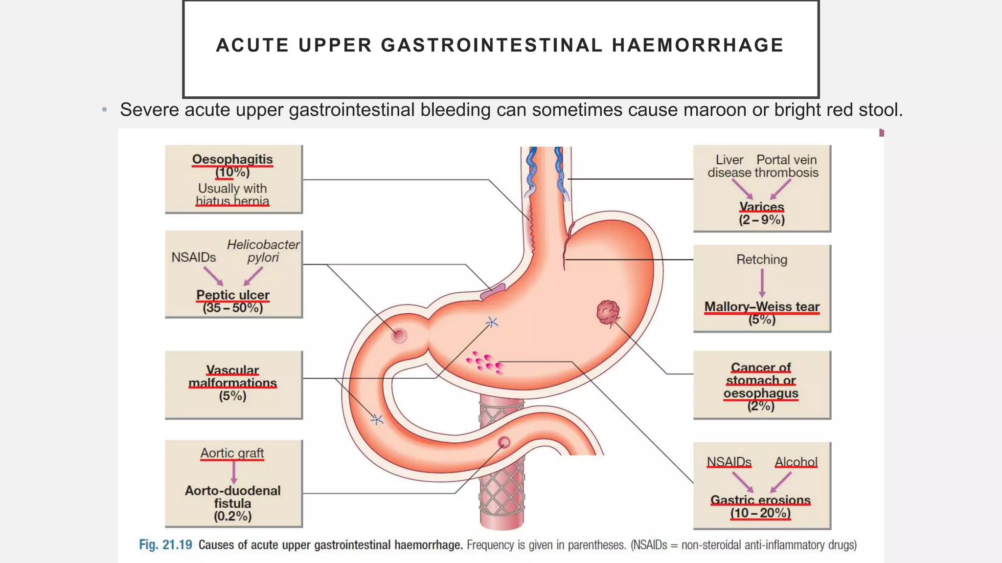 Gastrointestinal symptoms evaluation | PPTX