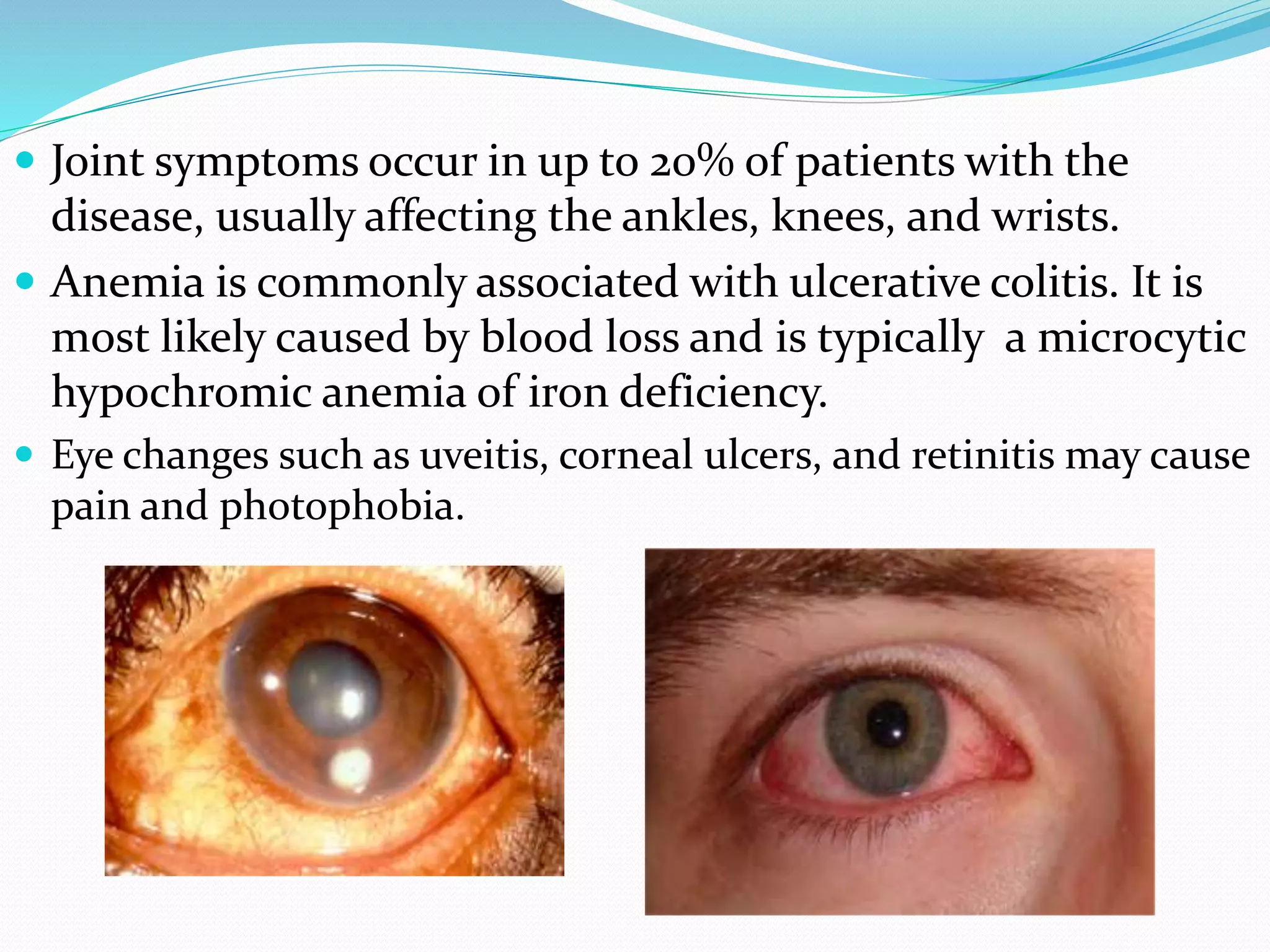 Gastrointestinal Tract Disorder | PPTX