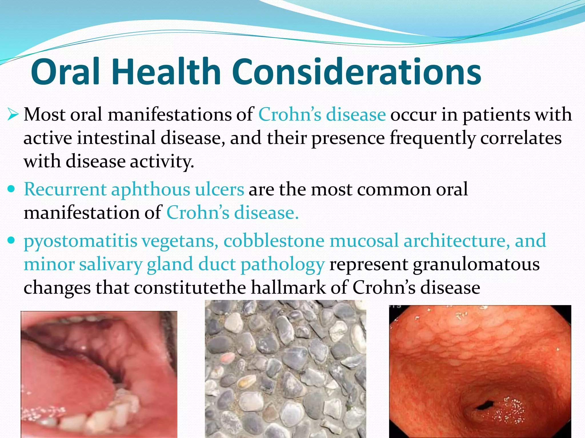 Gastrointestinal Tract Disorder | PPTX