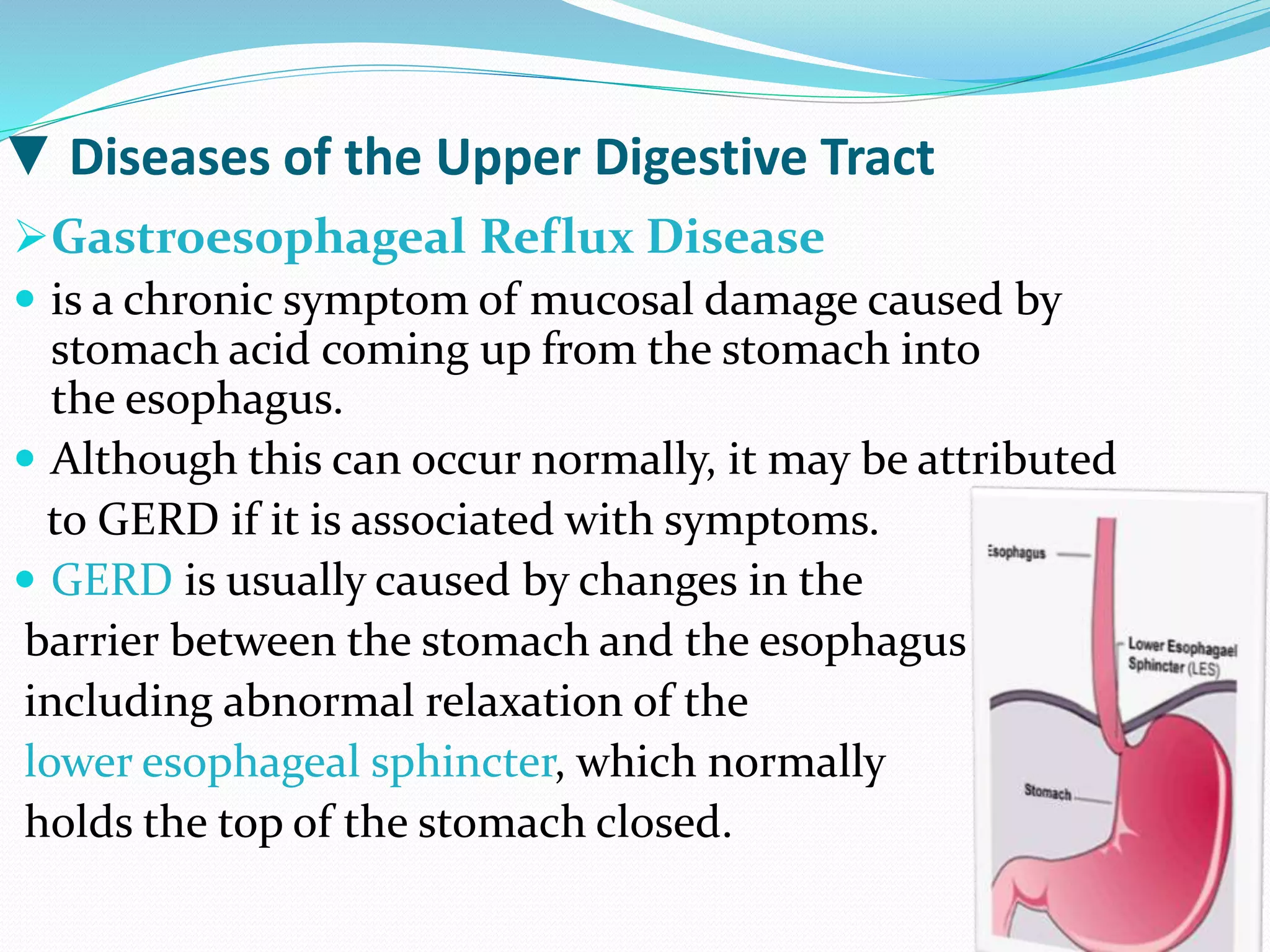 Gastrointestinal Tract Disorder | PPTX