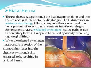 Gastrointestinal Tract Disorder | PPTX