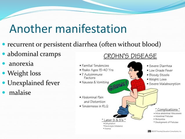 Gastrointestinal Tract Disorder | PPTX