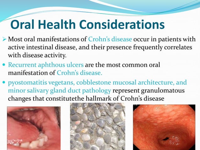 Gastrointestinal Tract Disorder | PPTX