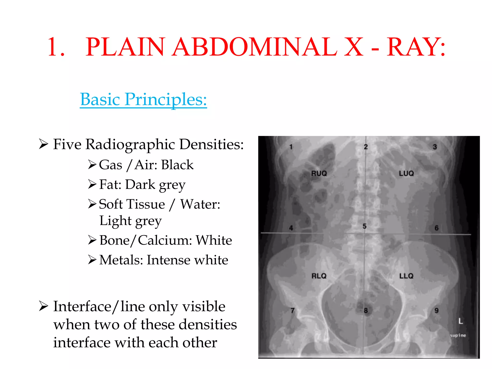 Gastro intestinal tract (abdomen) radiology | PPTX