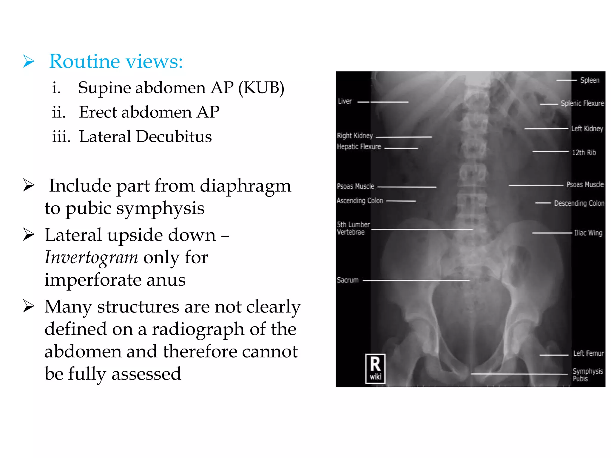 Gastro intestinal tract (abdomen) radiology | PPTX