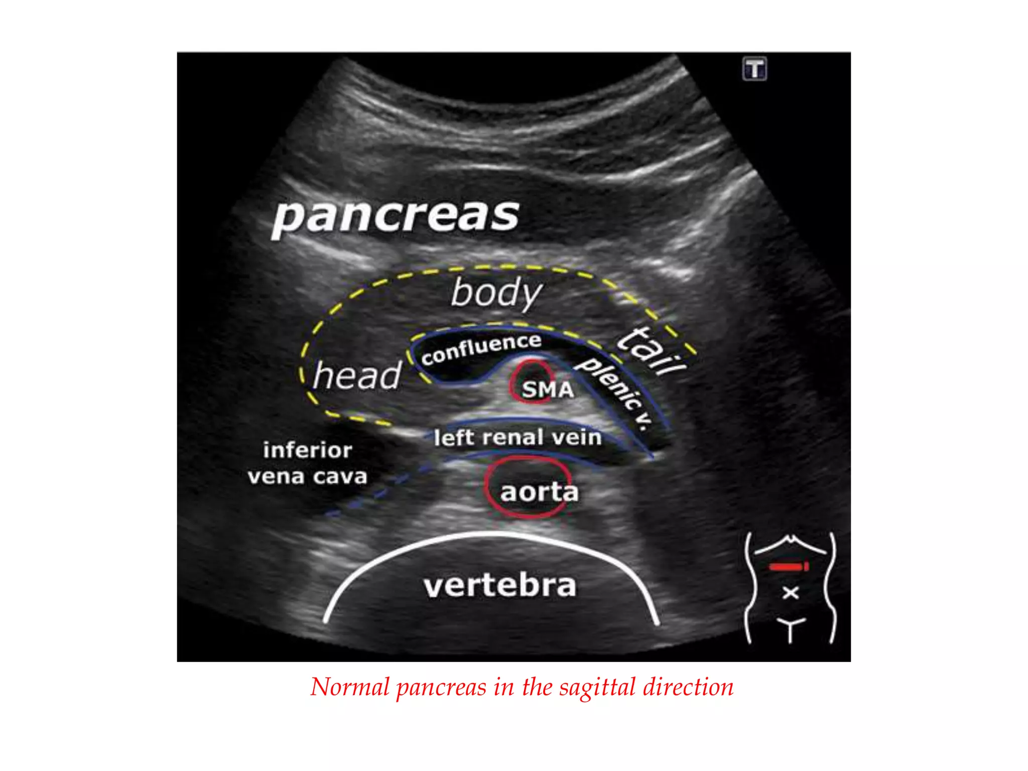 Gastro intestinal tract (abdomen) radiology | PPTX