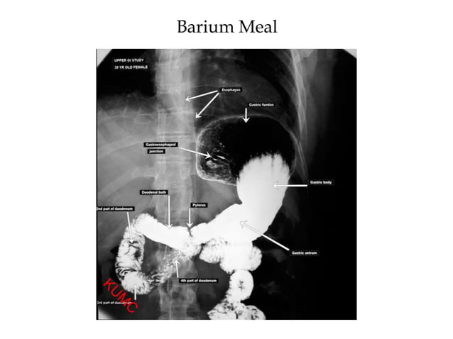Gastro intestinal tract (abdomen) radiology | PPTX | Digestive ...
