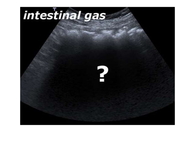Gastro intestinal tract (abdomen) radiology | PPTX | Digestive ...