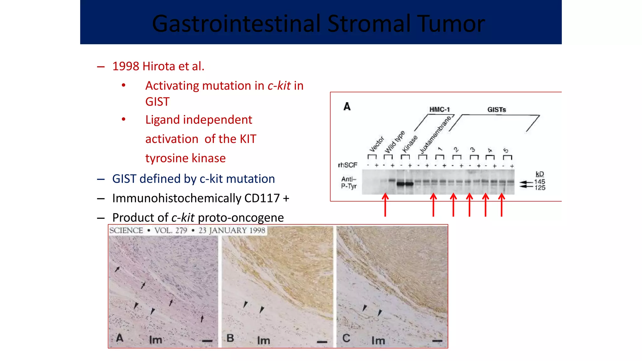 Gastrointestinal tumors | PPTX