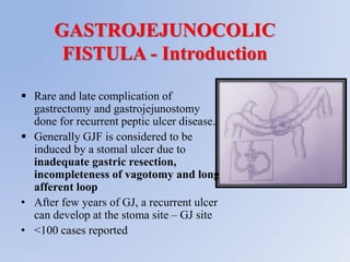 Gastrojejunocoilic fistula | PPTX