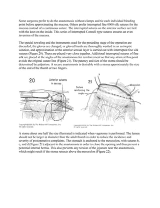 Gastrojejunostomy | DOC