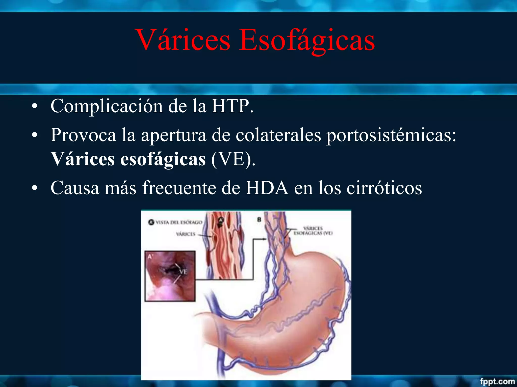ENCEFALOPATÍA HEPÁTICA, VARICES ESOFÁGICAS, PERITONITIS BACTERIANA ...