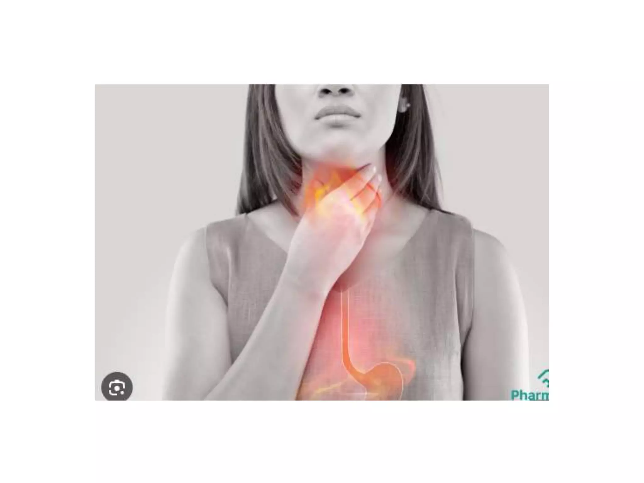 Gastro Oesophagal Reflux Disease GERD.pptx