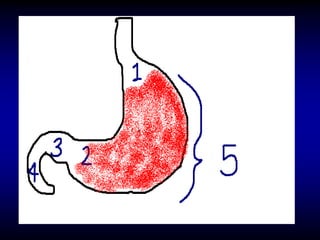 Gastroparesis slide.ppt