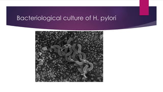 H. Pylori as an etiological factor in Peptic ulcer disease. | PPTX