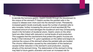 H. Pylori as an etiological factor in Peptic ulcer disease. | PPTX