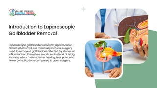 Laparoscopic Gallbladder Removal: Step-by-Step Overview | PDF