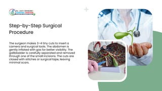 Laparoscopic Gallbladder Removal: Step-by-Step Overview | PDF