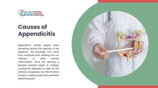 Understanding Appendicitis: Causes, Symptoms & Diagnosis | PDF