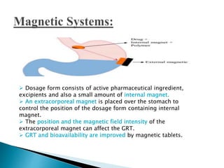 Gastroretentive Drug Delivery System -> by Mohit kumar | PPTX