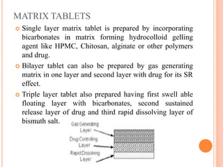 Gastro retentive drug delivery system | PPTX