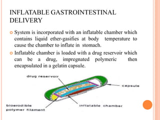 Gastro retentive drug delivery system | PPTX