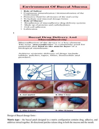 GASTRO RETENTIVE DRUG DELIVERY SYSTEM (GRDDS) | PDF