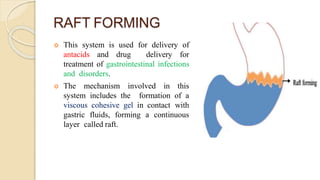 Gastro Retentive Drug Delivery System | PPTX | Digestive Disorders ...
