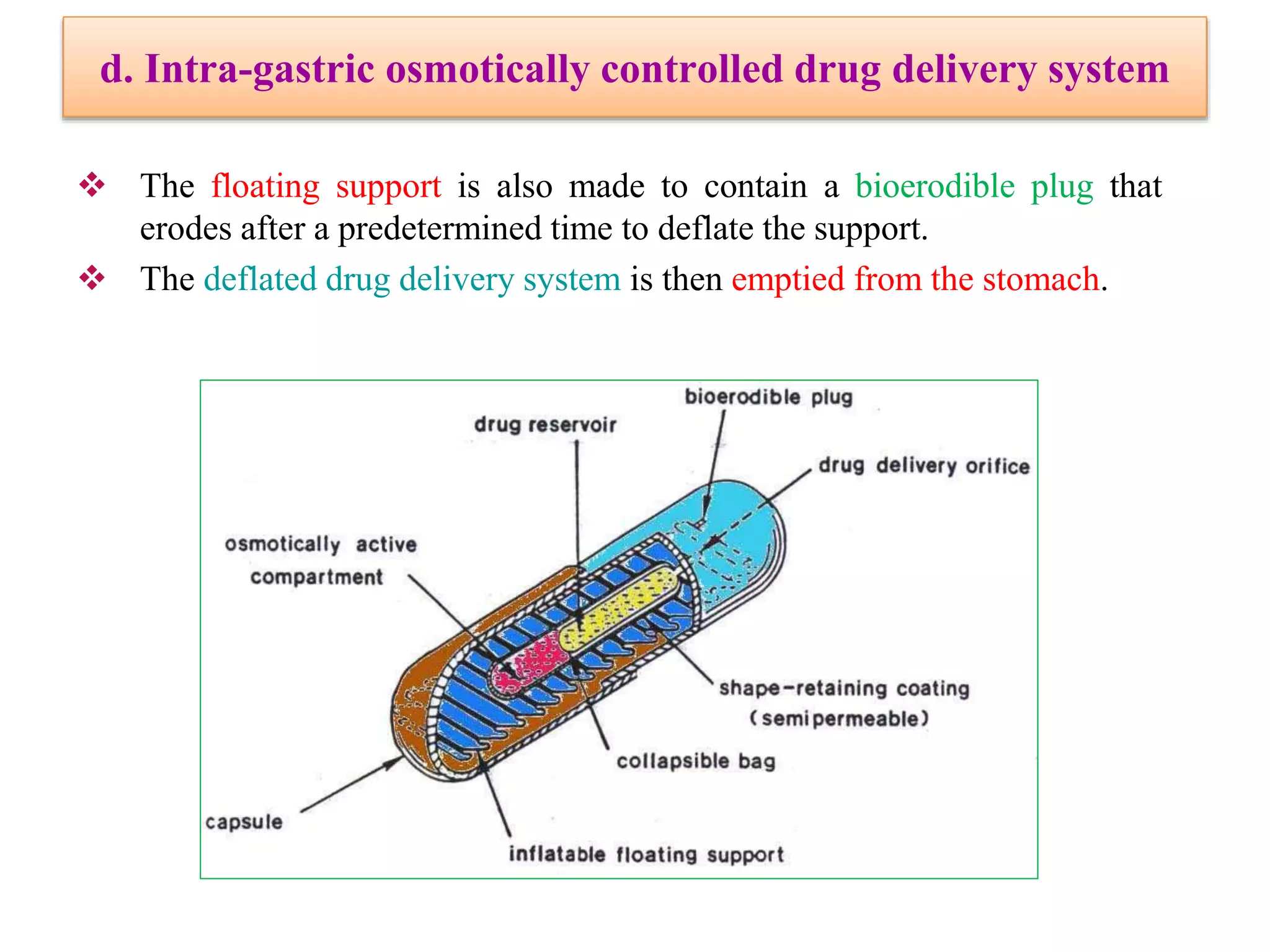 Gastroretentive drug delivery system by mali vv | PPTX