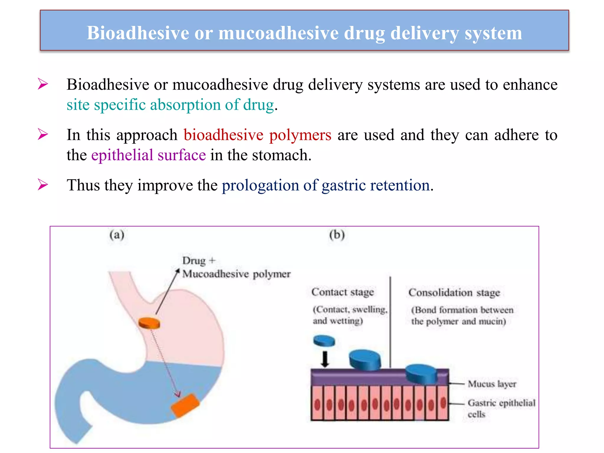 Gastroretentive drug delivery system by mali vv | PPTX