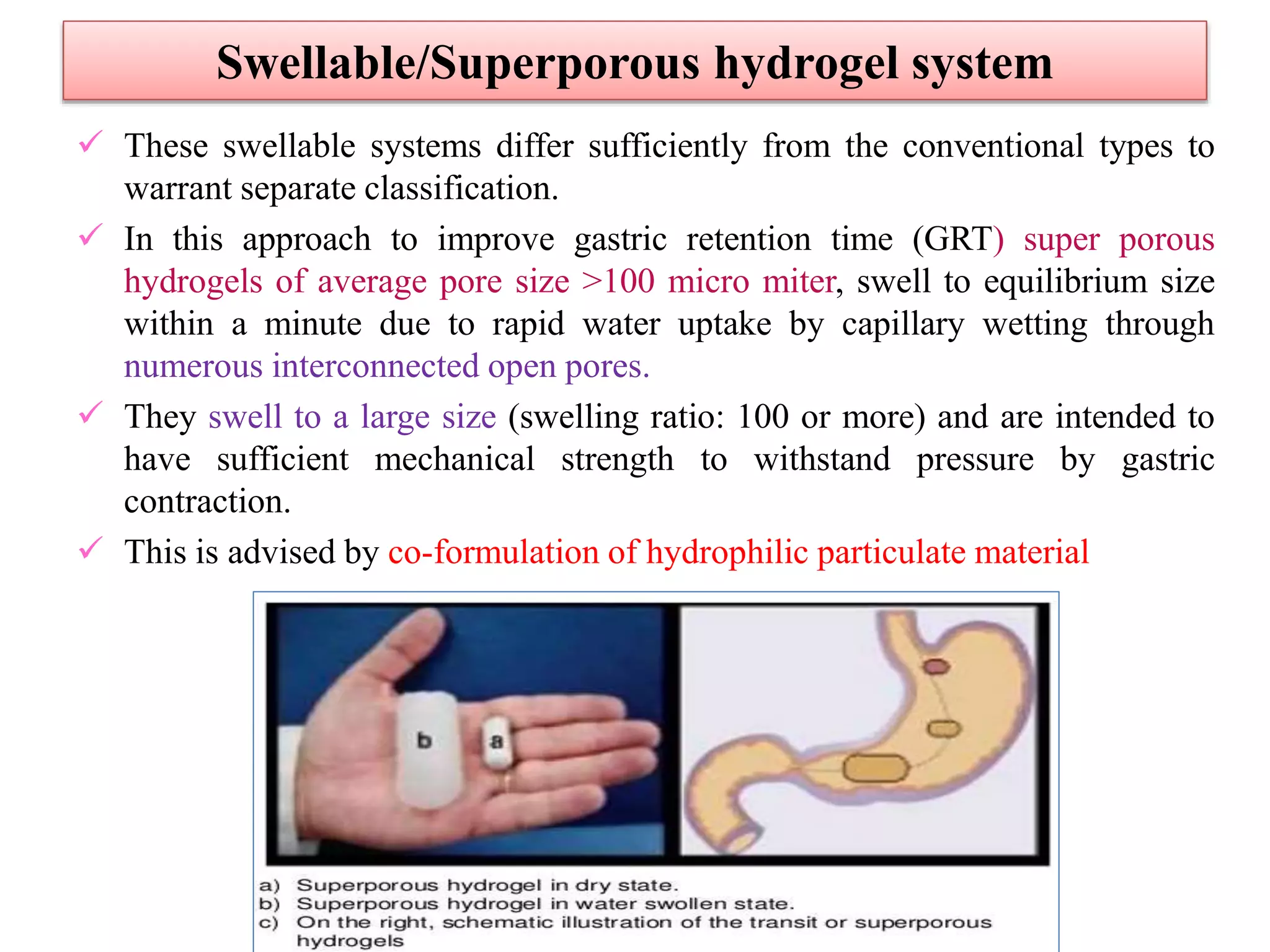 Gastroretentive drug delivery system by mali vv | PPTX