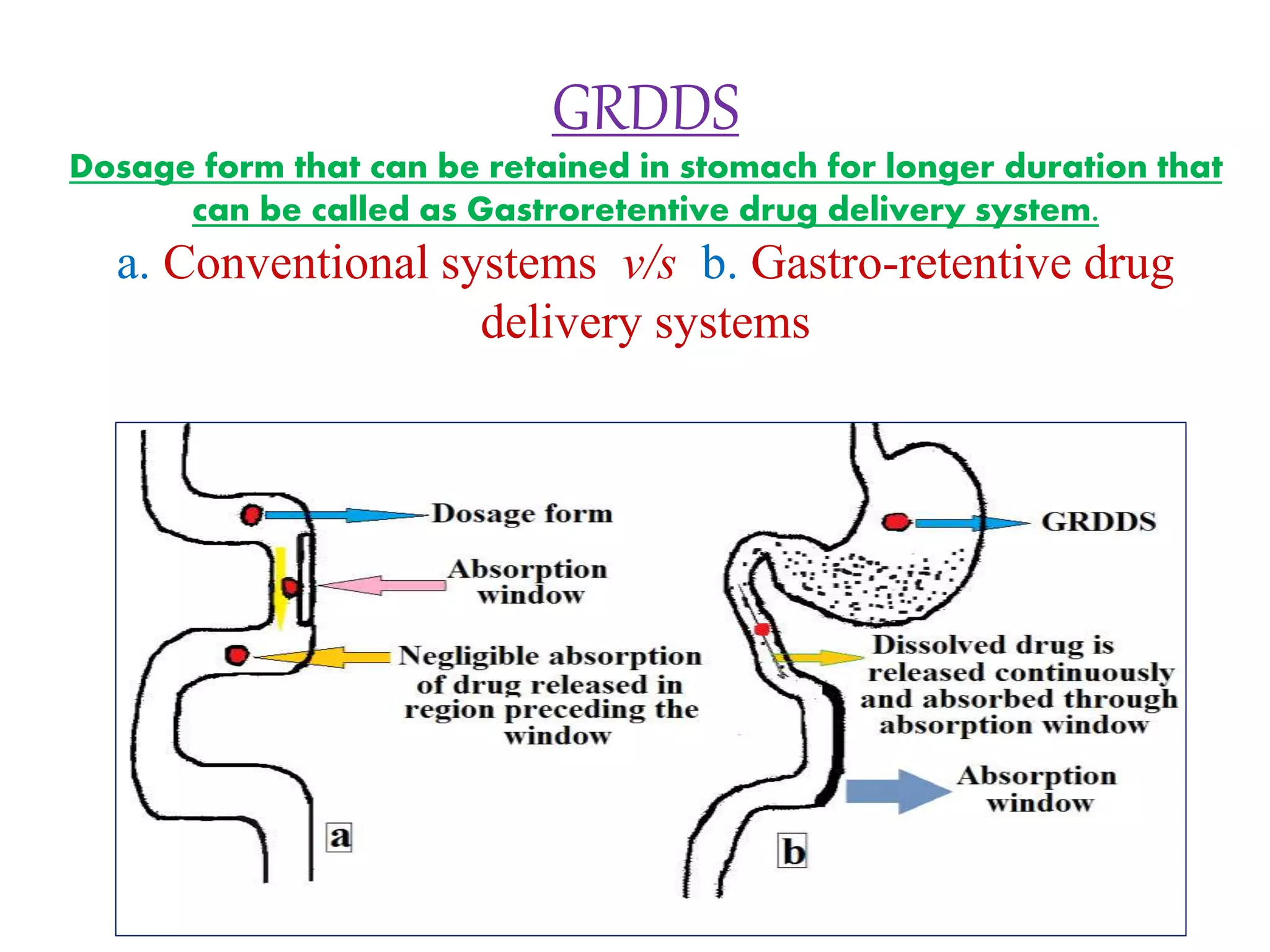 Gastroretentive drug delivery system by mali vv | PPTX