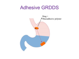Gastro retentive Drug Delivery Systems.ppt