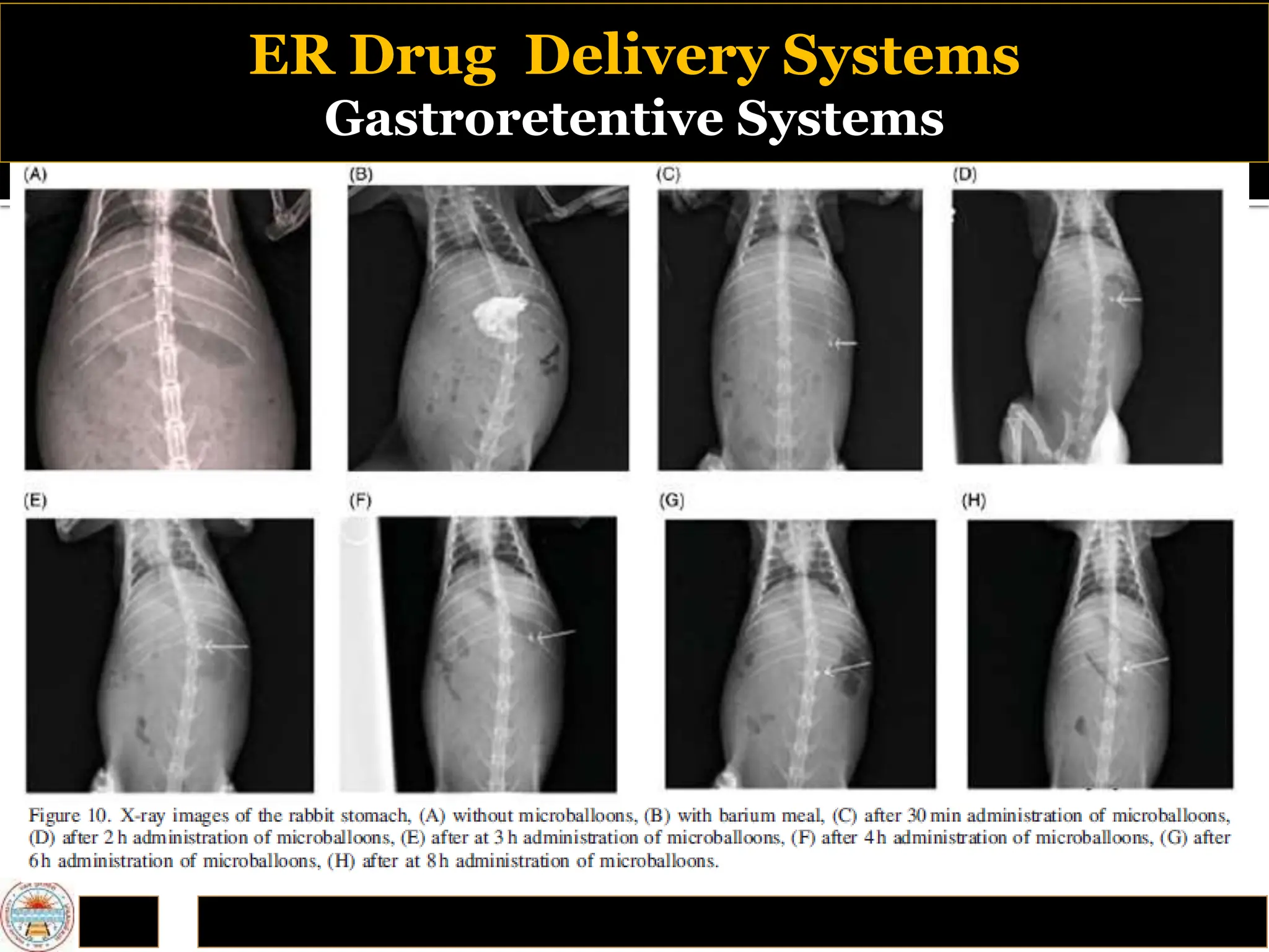 GASTRORETENTIVE DRUG DELIVERY SYSTEMS ppt.pptx