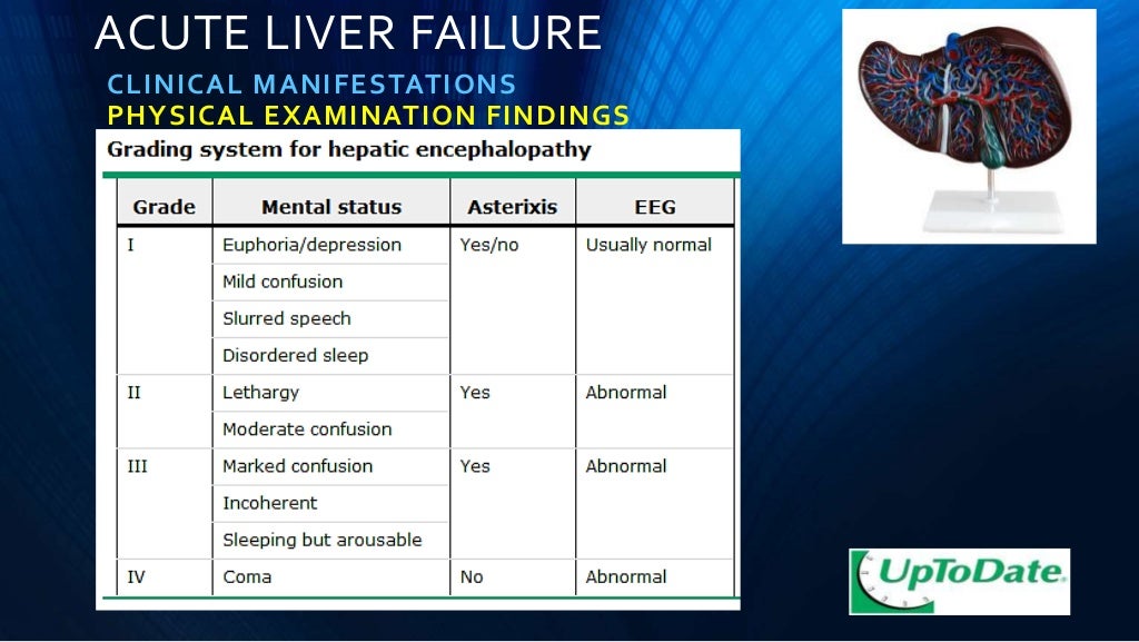 Acute Liver Failure