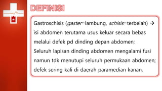 Gastroschisis dan omphalocele | PPTX