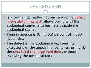 GASTROSCHISIS | PPTX