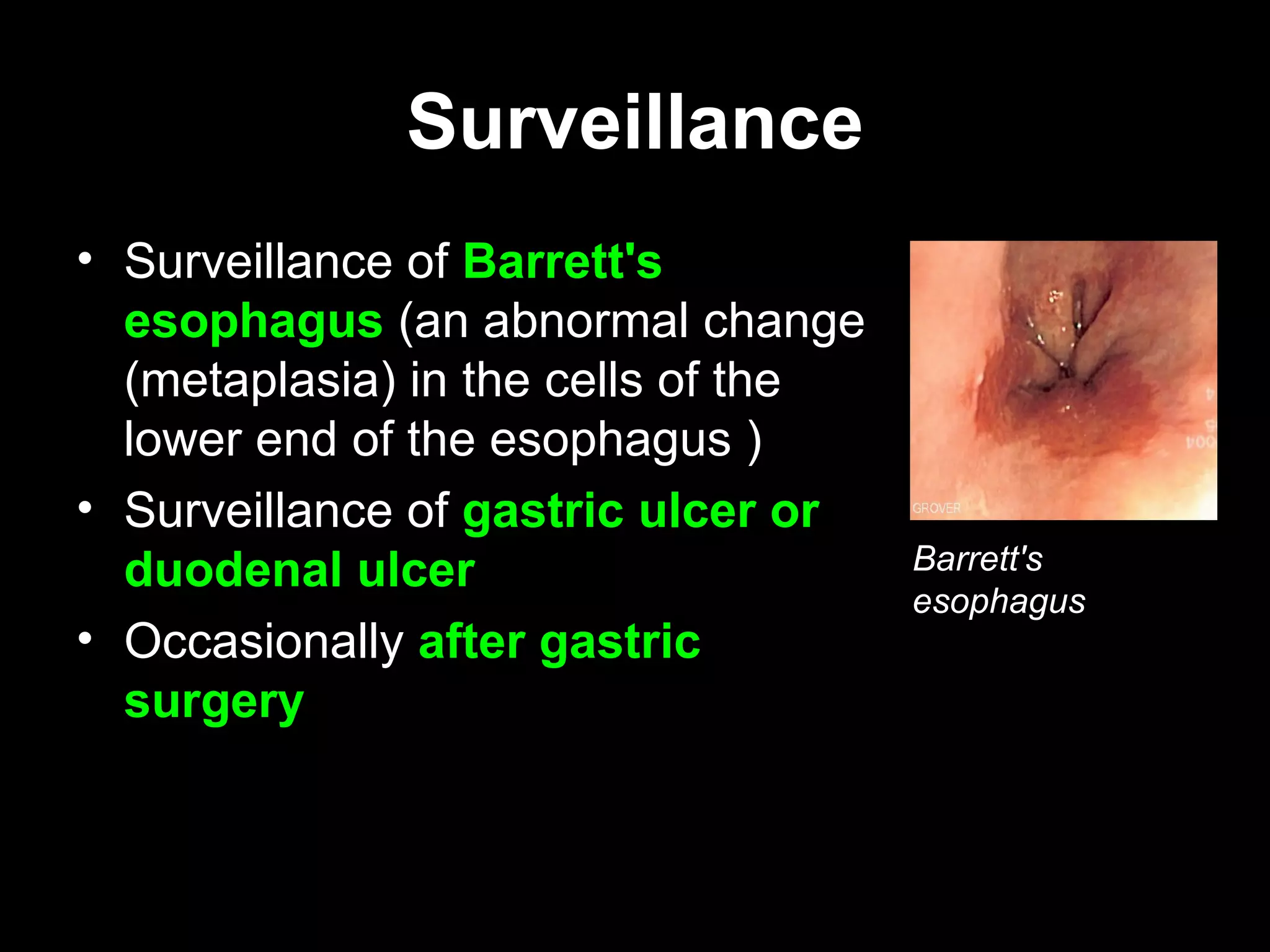 Gastroscope | PPT