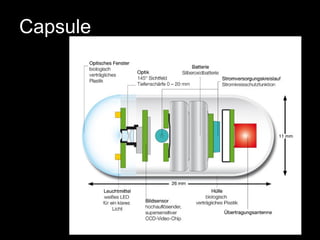 Gastroscope | PPT