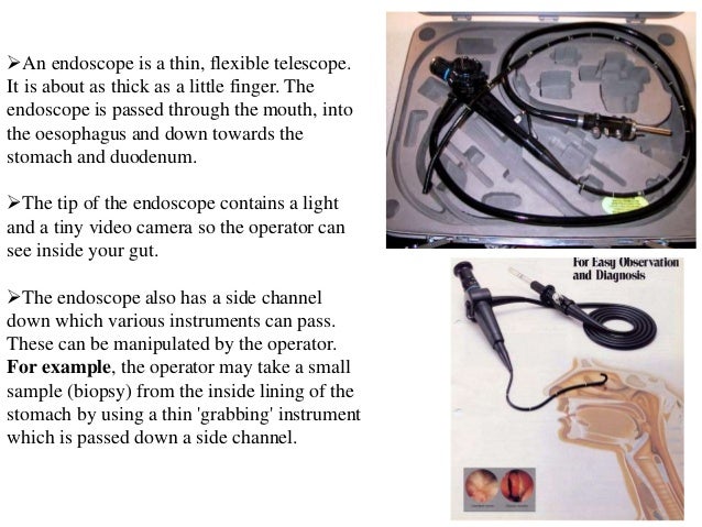 Gastroscopy