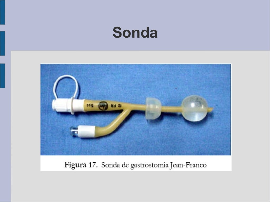 Gastrostomia Sonda