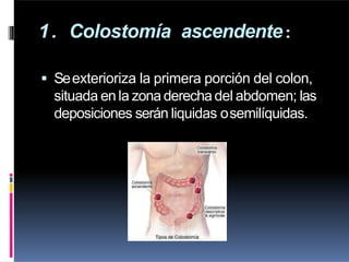 GASTROSTOMIAS Y COLOSTOMIAS. tipos y clasficaciones | PPTX