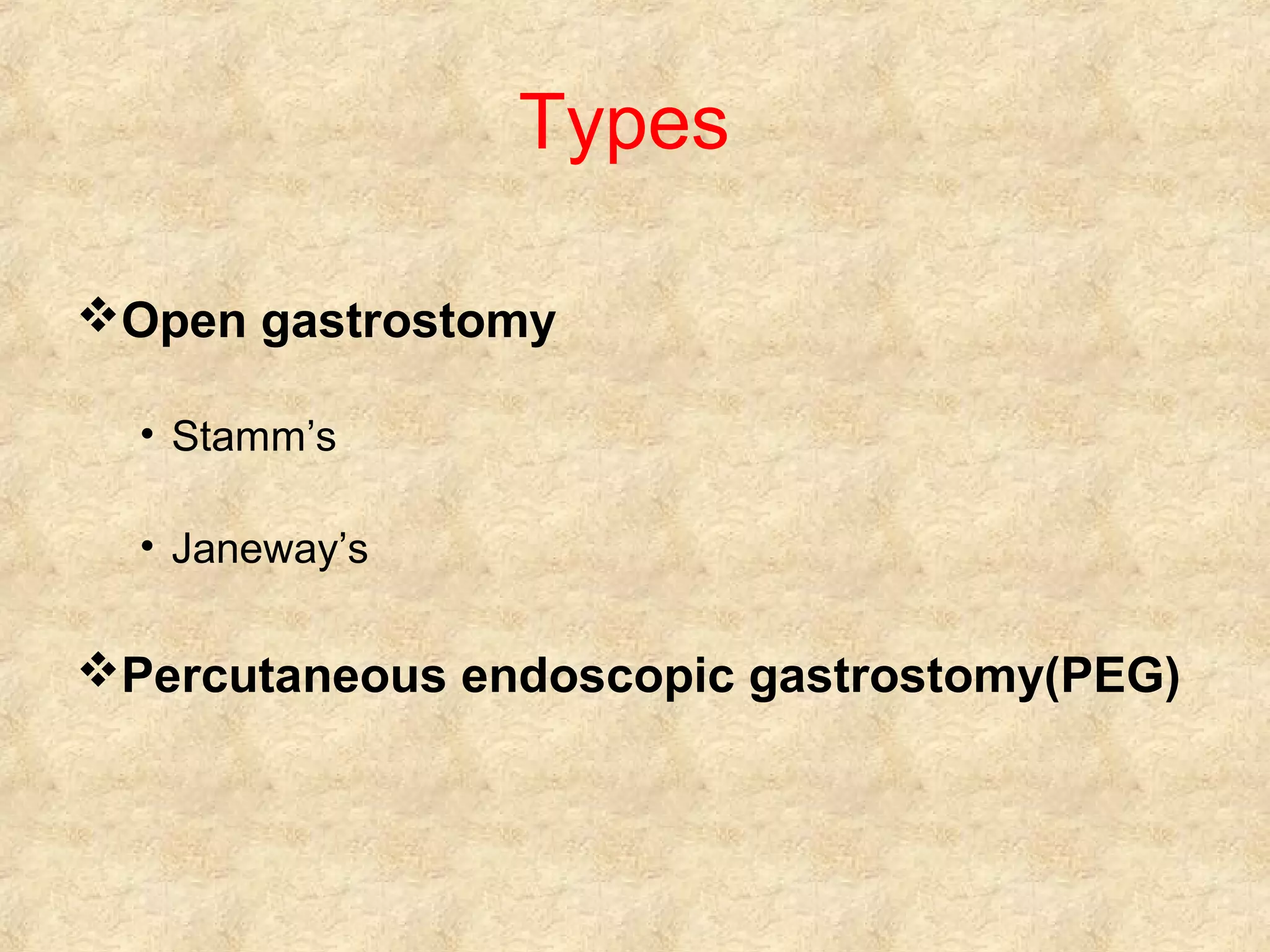 Gastrostomy | PPT